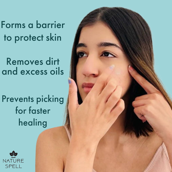 Nature Spell Clear My Spots Pimple Patches - 36 Translucent Hydrocollo